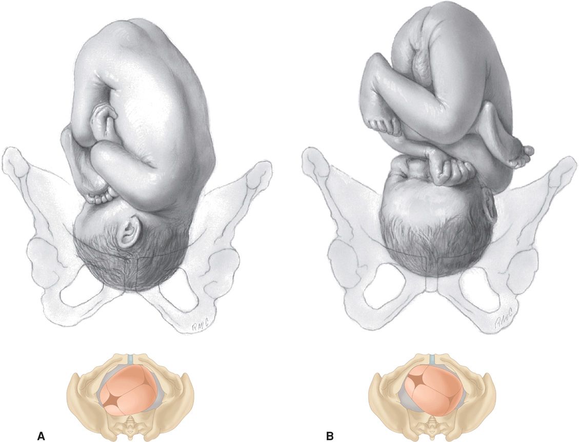 Normal Labor Obgyn Key