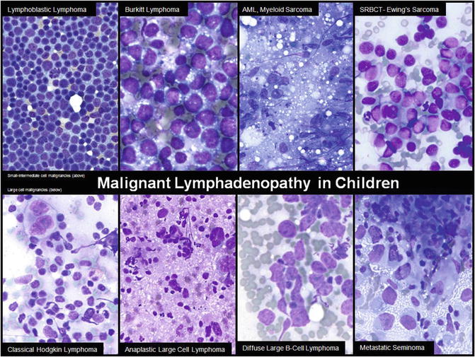 Lymph Nodes Obgyn Key