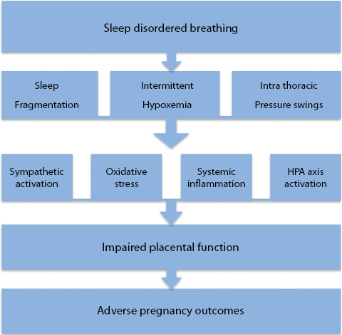 Sleep And Pregnancy Complications Obgyn Key