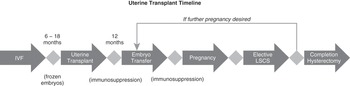 Chapter 9 – Rokitansky Syndrome | Obgyn Key